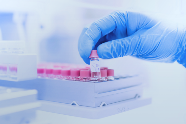 Preanalytical Variables Critical For Appropriate Diagnosis Lab Testing Matters
