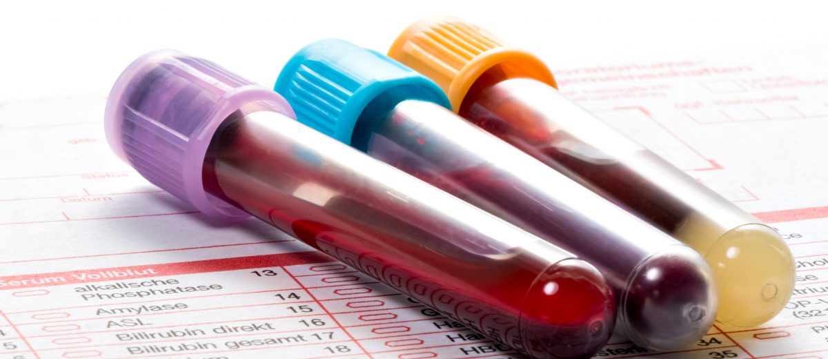 Preanalytical Variables Critical For Appropriate Diagnosis Lab