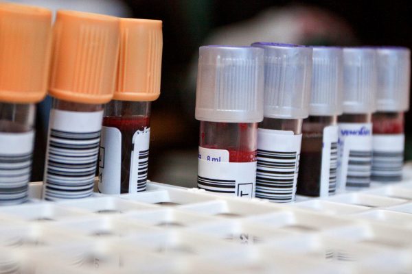 The Importance of Proper Specimen Collection and Handling – Lab Testing ...