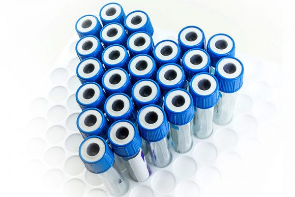 The Importance of Proper Specimen Collection and Handling – Lab Testing ...